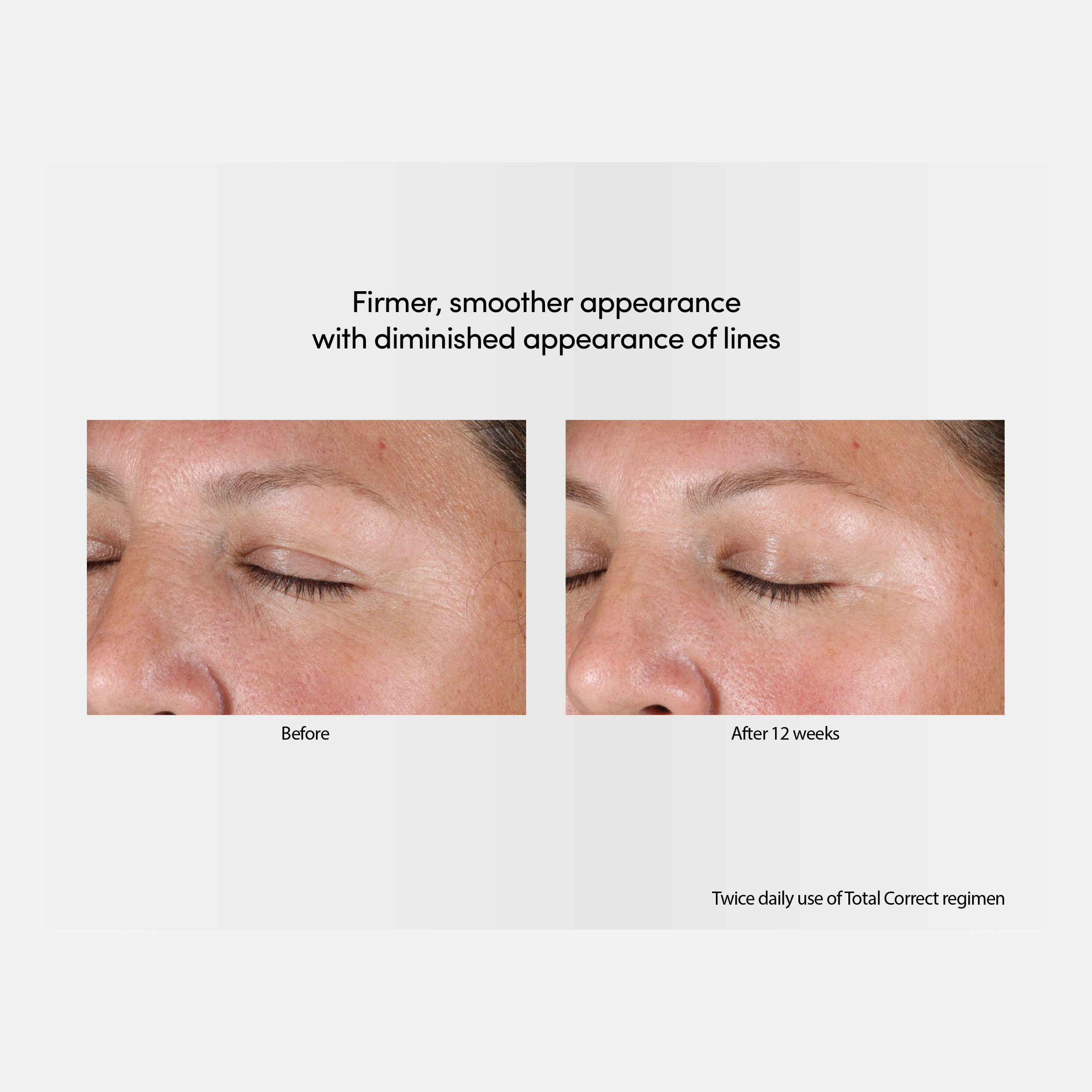 Exuviance Age Reverse Eye Contour 15g | Dermaskinshop SG